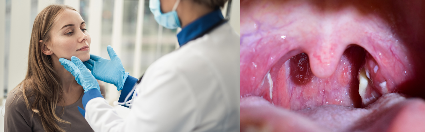 Tonsil and Adenoid Surgery - Dr Murali Mahadevan - ENT Surgeon